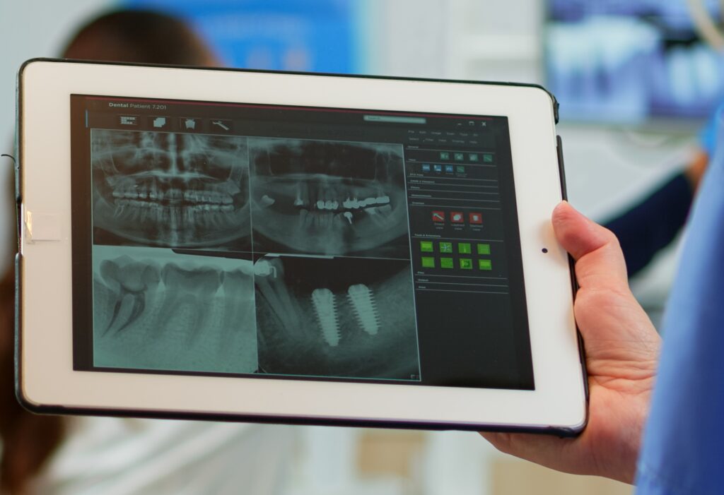 Development and training of neural networks - Epol Soft